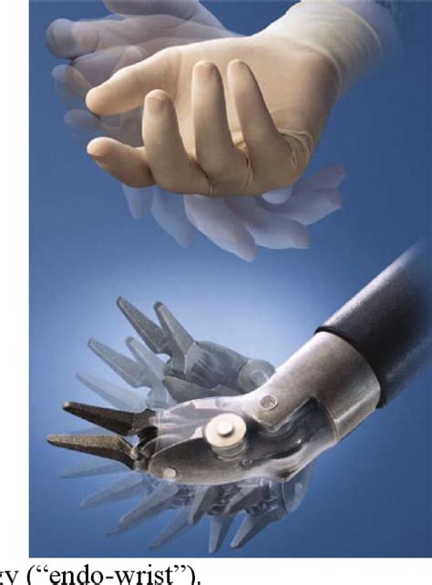 Figure 2 From The Role Of Surgical Robotic Systems In Operative Urology