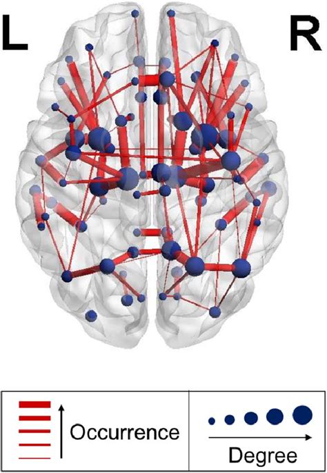 FIG URE 4 Intersubject Variability Of MST Connections Visualization Of Download Scientific