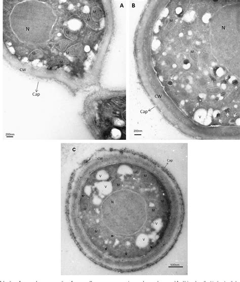 Figure 1 From Cryptococcus Neoformans Cryoultramicrotomy And Vesicle