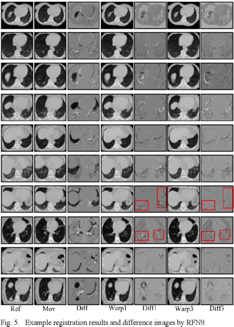 Figure 1 From Residual Fully Convolutional Deformable Registration Network For Deformable Lung