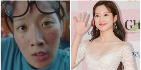 Top 30 Ugly Celebrities Without Makeup Saubhaya Makeup