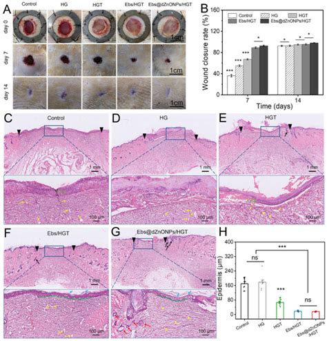 A Dznonps Enhanced Hybrid Injectable Photocrosslinked Hydrogel For