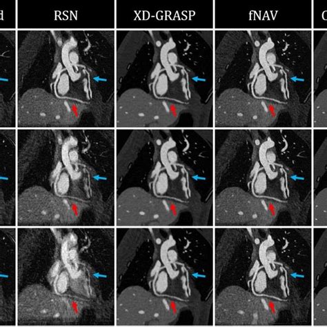 Curved Reformats Of Simulated Data Reconstructions At Increasing Levels Download Scientific