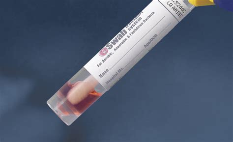 Antibiotic Stewardship Role Of Mrsa Nasal Screening