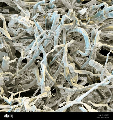 Absorbent Wound Dressing Coloured Scanning Electron Micrograph Sem