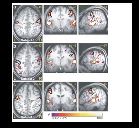 Cognitive Psychology Cognitive Models And Neural Basis For Speech