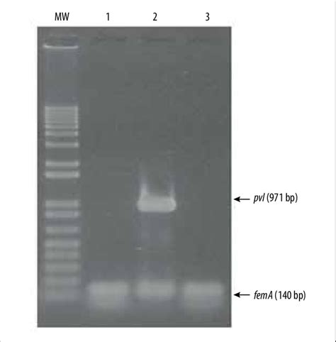 Pcr Of The Panton Valentine Leukocidin Pvl Gene From Staphylococcus
