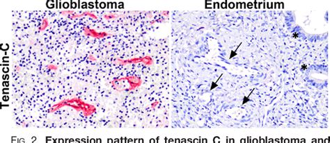 Figure 1 From A Proteome Comparison Between Physiological Angiogenesis