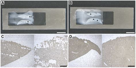 The Effect Of Adhesive Volume On The Efficiency Of Cryojane Section Download Scientific Diagram