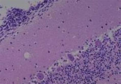 Novus Biologicals Human Multi Tissue Tissue Microarray Cancer Human