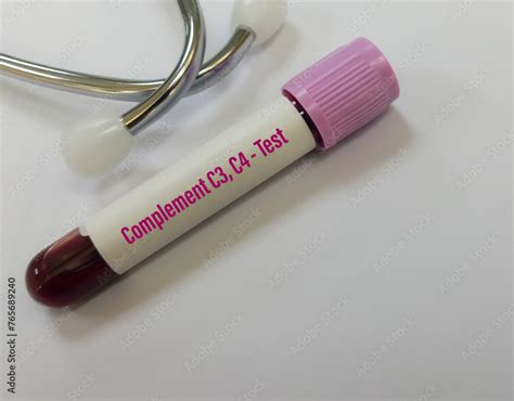 Blood Sample For C3 C4 Complement Test With Laboratory Background