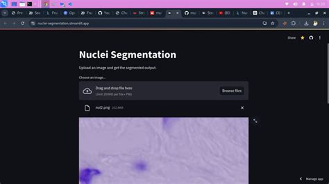 Nuclei Segmentation Application With Streamlit Muhammad Rizwan Posted