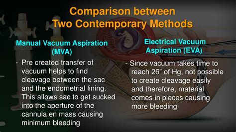 PPT MVA PowerPoint Presentation Free Download ID