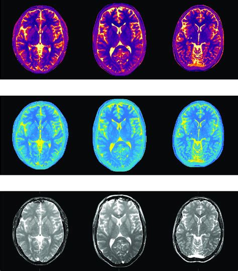 T 1 T 2 And Proton Density Magnitude Maps Reconstructed With
