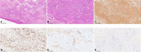 A Clinical And Histopathological Analysis Of 45 Cases Of Cutaneous