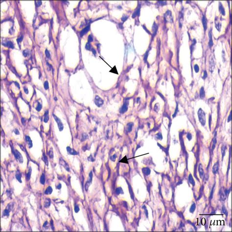 Expression Of Cd81 And Cd63 A Cd81 Expression In Normal Ovarian