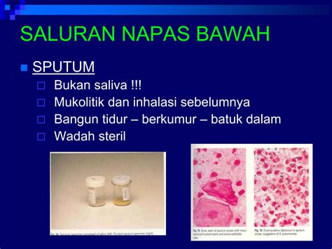 Pemeriksaan Saluran Nafas 2024ppt