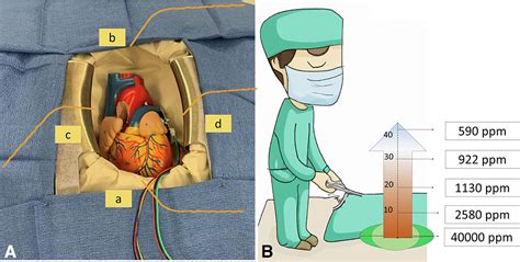 Concentration Of Insufflated Carbon Dioxide During Open Cardiac Surgery Jtcvs Techniques