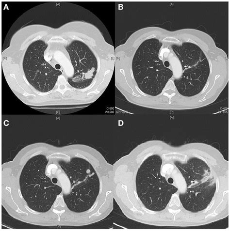 Epidermal Growth Factor Receptor Pathway Download Scientific Diagram