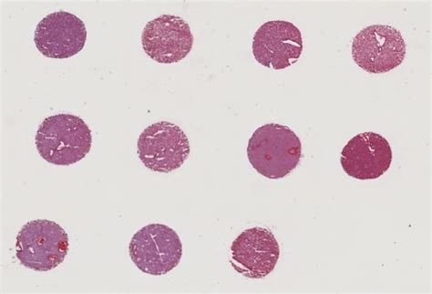 Frozen Tissue Slides And Sections Biochain Institute Inc