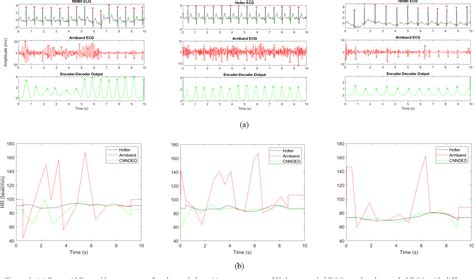 Figure From Improving The Accuracy Of R Peak Detection In A Wearable Armband Device For Daily