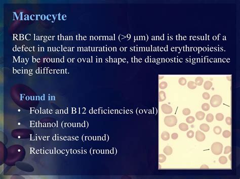 Ppt Rbcs Morphology Powerpoint Presentation Free Download Id2241450