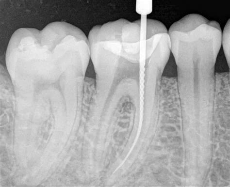 Endodoncia Carmen Torres Ortodoncia