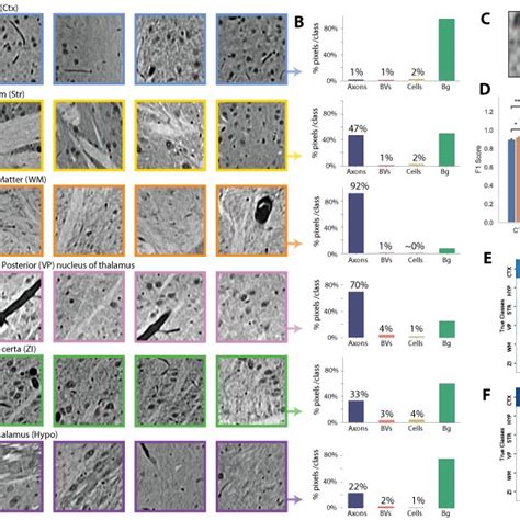 Deep Feature Learning Approach For Modeling Brain Microarchitecture At Download Scientific