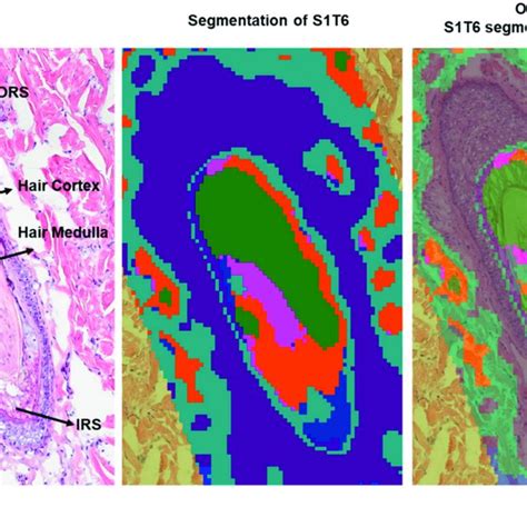 histology and segmentation analysis of hair follicle 3 download