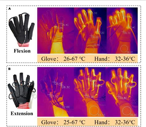 Figure 1 From Design Of A Sma Based Soft Composite Structure For Wearable Rehabilitation Gloves