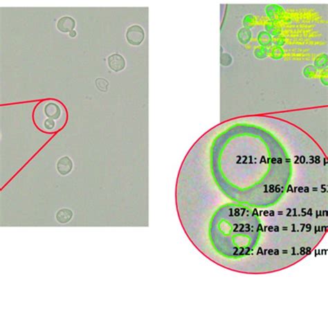 Pdf Yeast Morphology Assessment Through Automated Image Analysis During Fermentation
