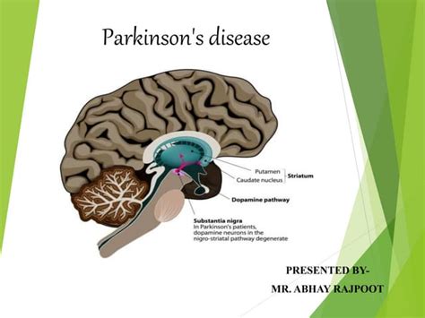 Parkinsons Pptx