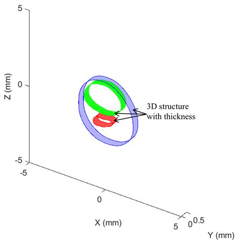 Intravascular Ultrasound Image Based Finite Element Modeling Approach For Quantifying In Vivo
