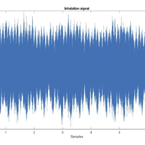Acoustic Monitoring System For Asthma Patients Download Scientific