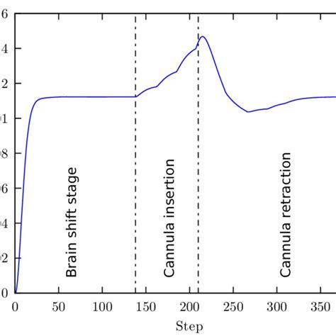 Brain At Initial State A And Brain Deformation Due To Brain Shift Download Scientific