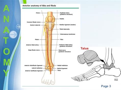 Pilon Fractures Or Plafond