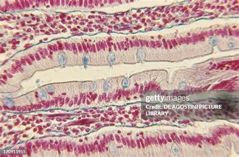 Duodenum Micrograph Photos And Premium High Res Pictures Getty Images