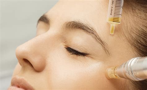 The Ultimate Guide To Prp Treatment In Singapore Marketsmiths