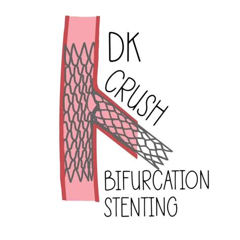 Dk Crush Technique There Are Many Variations Here Is An Example Of One