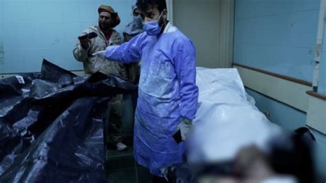 「中世でも見ない拷問」 損壊した遺体、シリア首都の安置所の内側 Jp