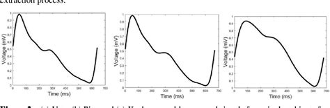 Figure 1 From High Dimensional Feature Space For Diabetes Diagnosis And