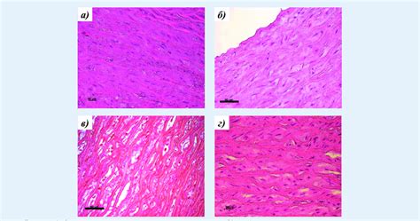 Structure Of Native Extracellular Matrix After A 50 Day Treatment Structure Of Native Extracellular Matrix After A 50 Day Treatment