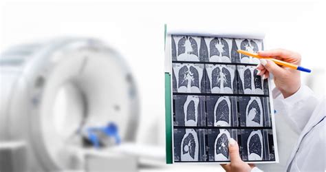 Can Chest CT Scans Show Inflammation CT Heart Scans