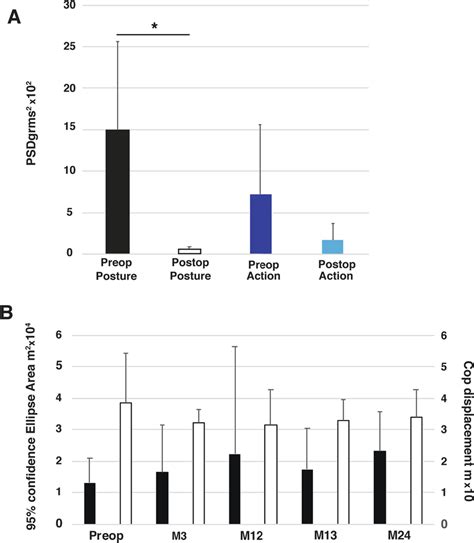 Vim Dbs Clinical Effectiveness And Its Impact On Balance A