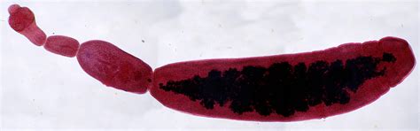 Echinococcus Multilocularis Morphology