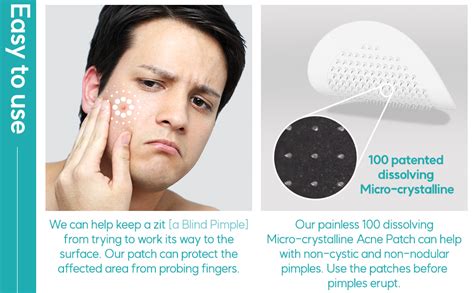 Vilvin Microdart Acne Patch Zit Patches For Face 27 Ea Vilvin Microdart Acne Patch Zit Patches For Face 27 Ea