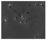 Diagnostics Free Full Text YOLOv S SA Light Weighted And Improved YOLOv S For Sperm Detection