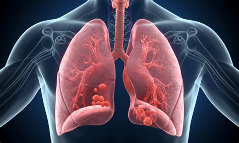 Totzone Sbcodez Swag Codez