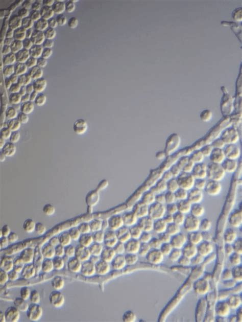 Help Id R Microscopy