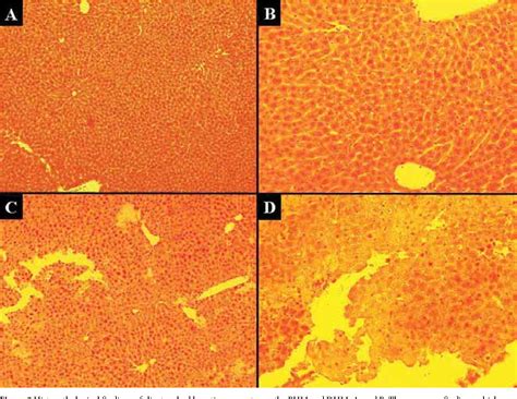 Figure 8 From Simple And Sure Methodology For Massive Hepatectomy In